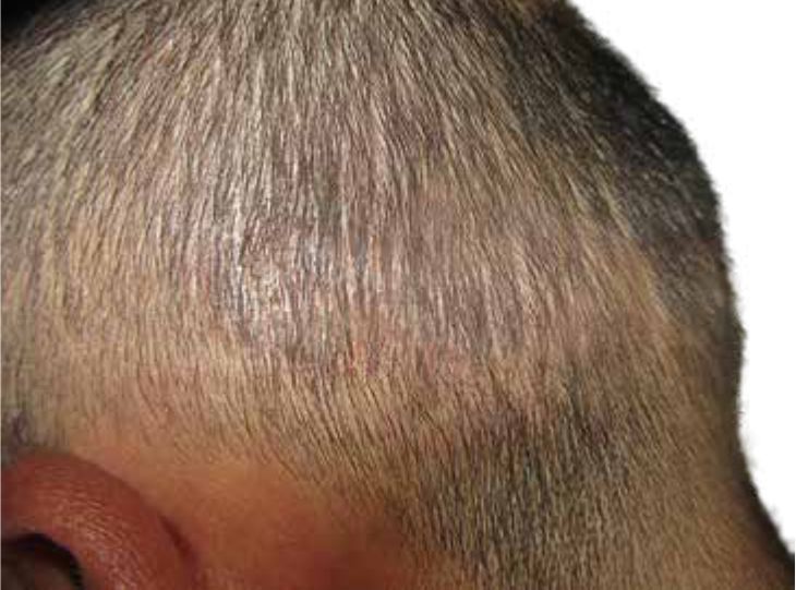 Kopfhautpigmentierung – Professionelles Nagelstudio Fürstenfeldbruck