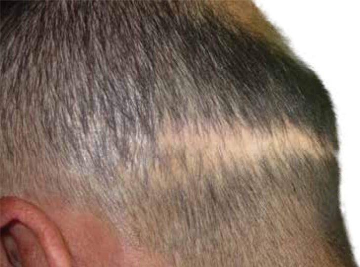 Kopfhautpigmentierung – Professionelles Nagelstudio Fürstenfeldbruck